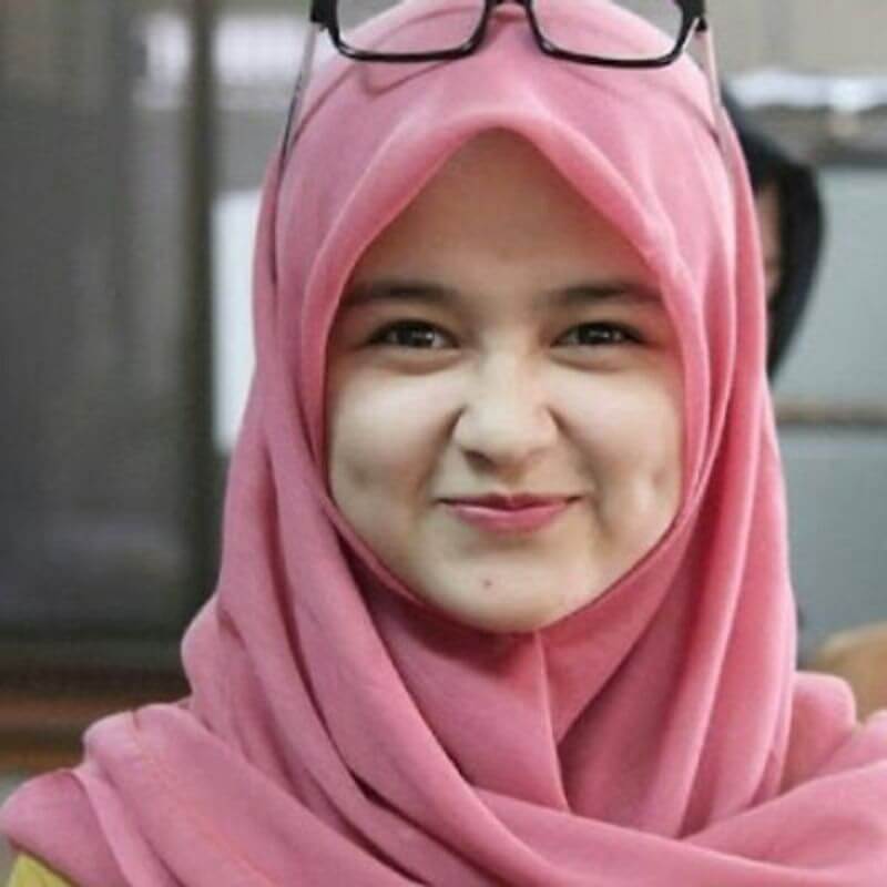 Fakta Mengenai Lesung Pipit | Memang Manis Tapi Ia Sebenarnya Kecacatan