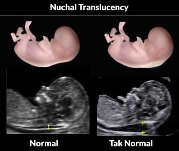 Jenis-jenis Scan yang Mama Perlu Lakukan Semasa Mengandung - 2026