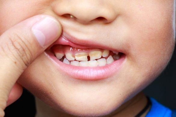 7 Punca Gegata dan Rawatan Segera Yang Boleh Dilakukan