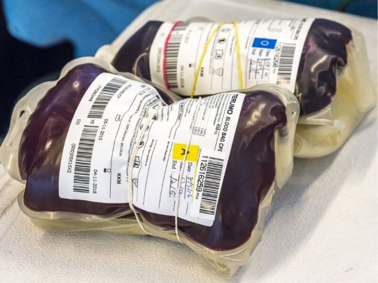 Apa Kata Pakar: Mengapa Derma Darah Penting untuk Kesihatan