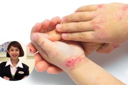 Mengapa Kita Boleh Menjangkiti Kayap Ular? Memahami "Herpes Zoster"